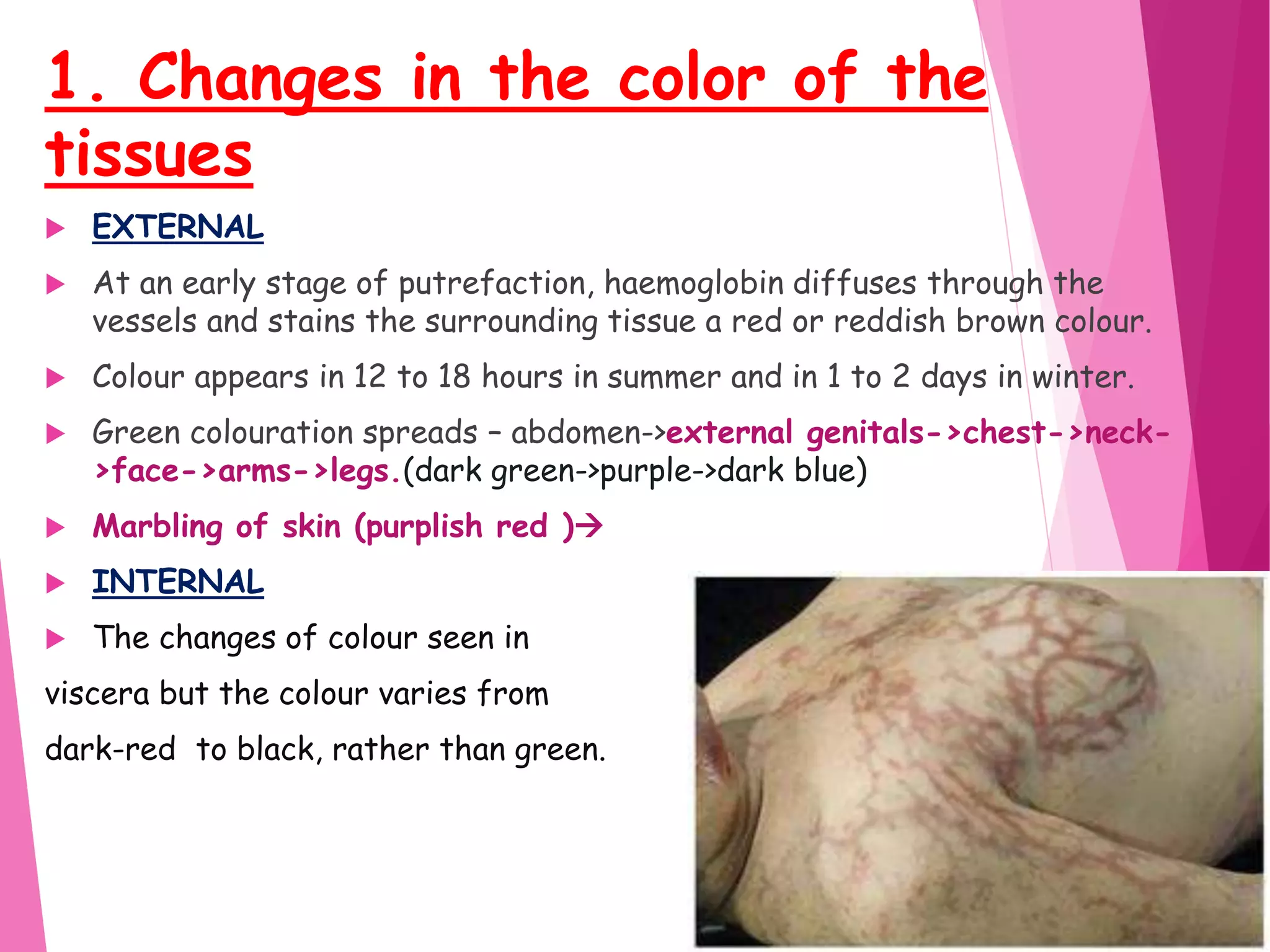 Forensic medicene,putrefaction | PPTX