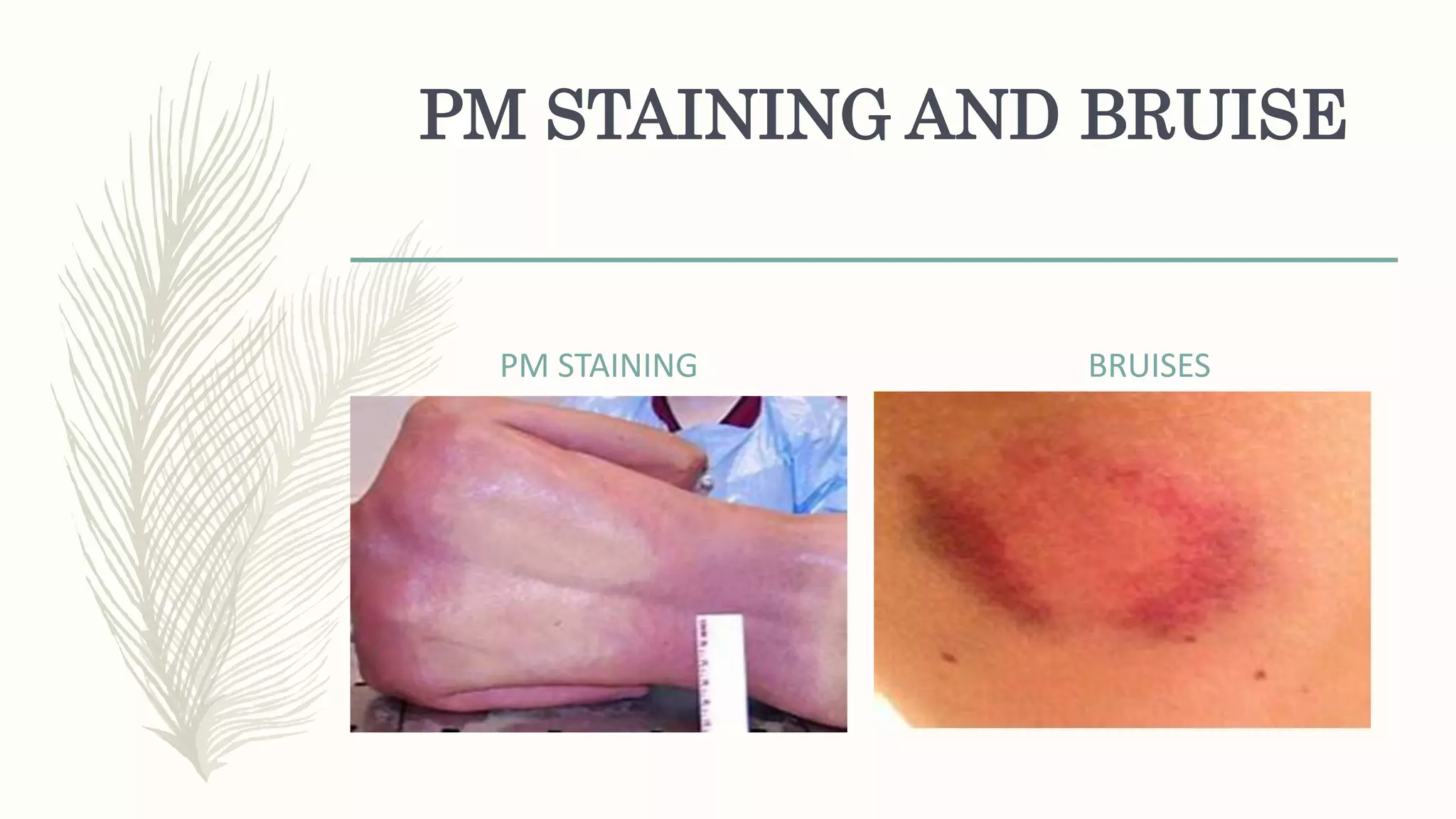 FORENSIC MEDICINE - STAGES OF DEATH | PPTX