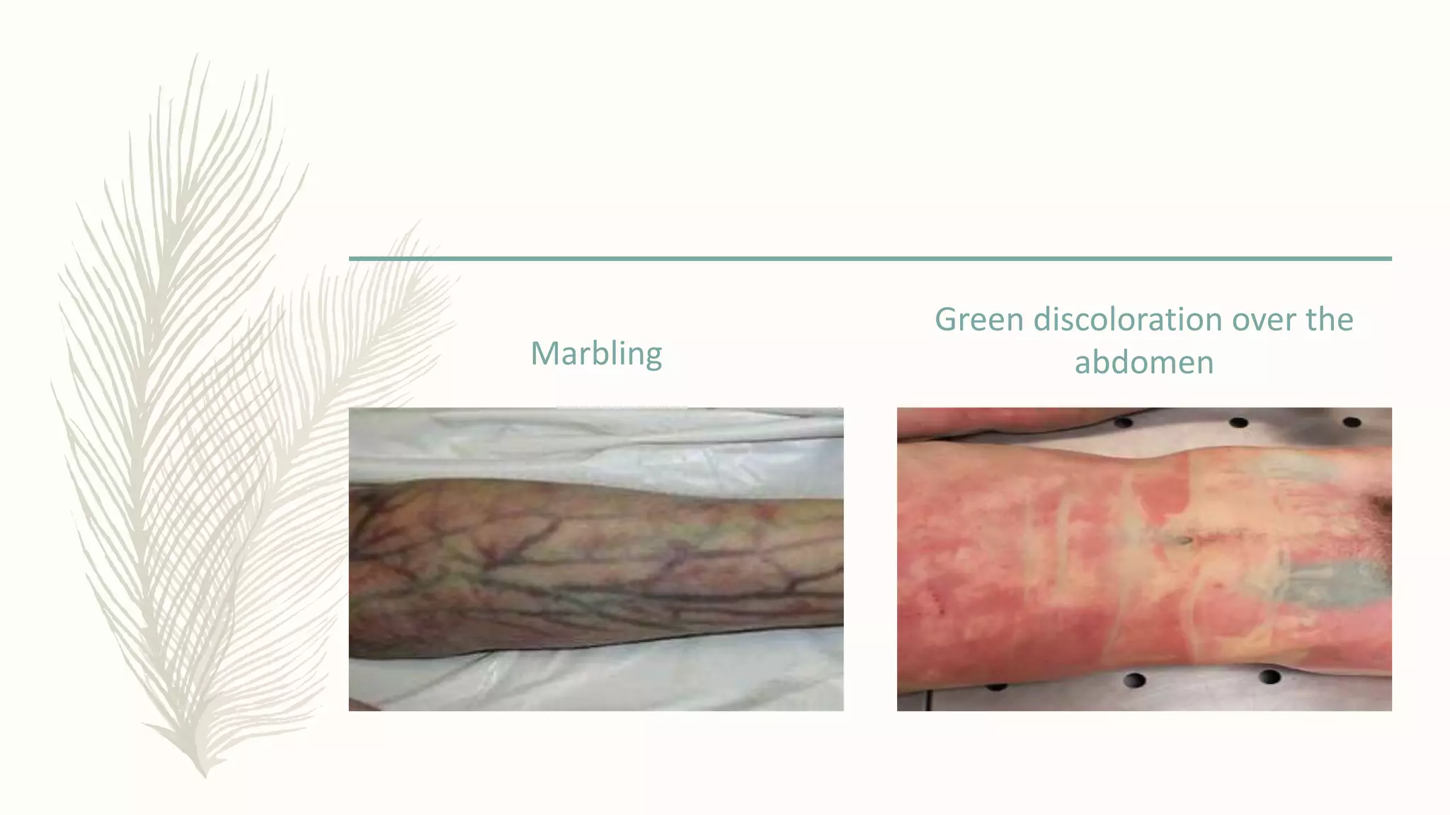 FORENSIC MEDICINE - STAGES OF DEATH | PPTX