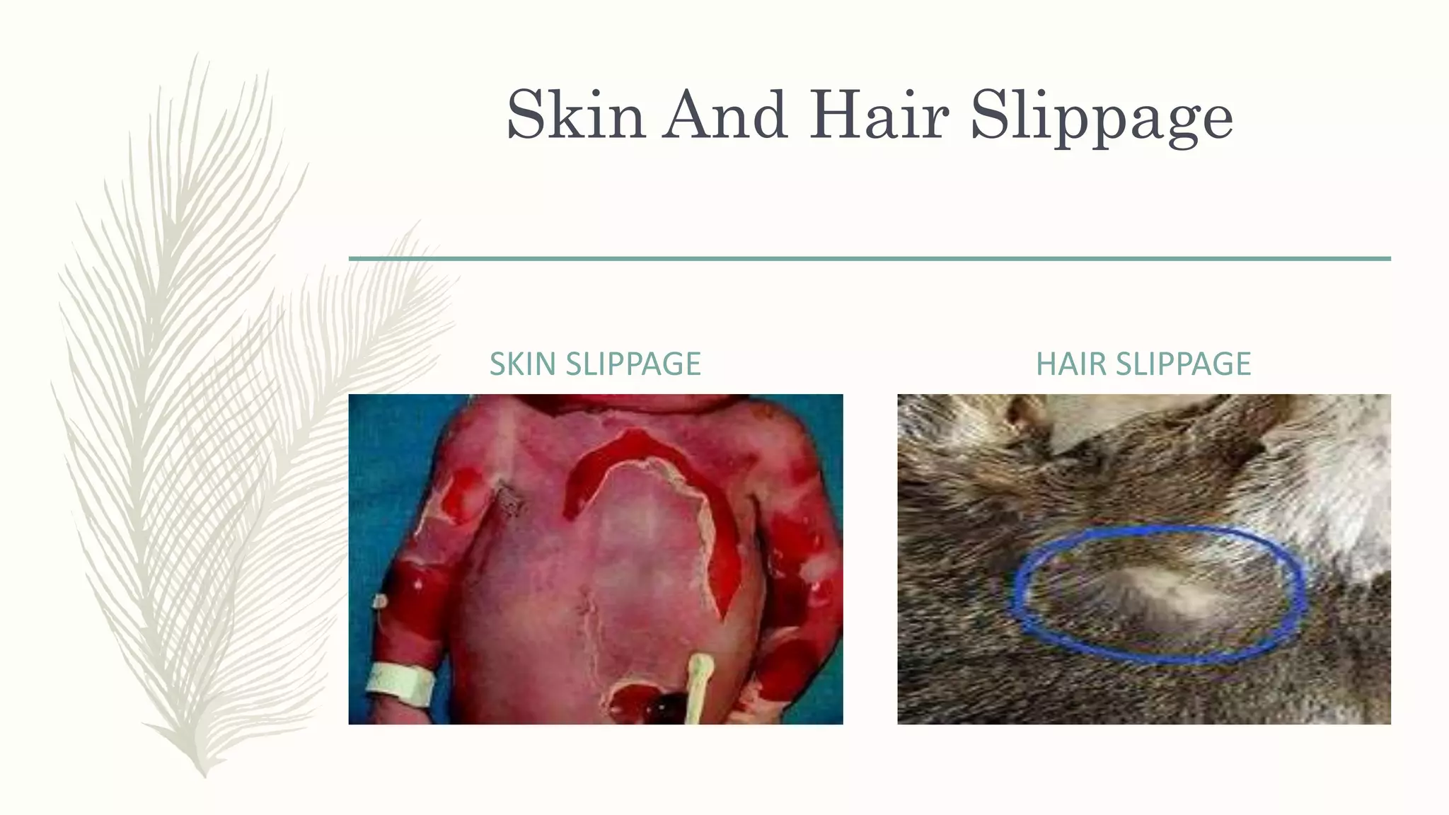 FORENSIC MEDICINE - STAGES OF DEATH | PPTX