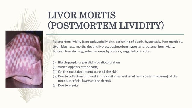 FORENSIC MEDICINE - STAGES OF DEATH | PPTX
