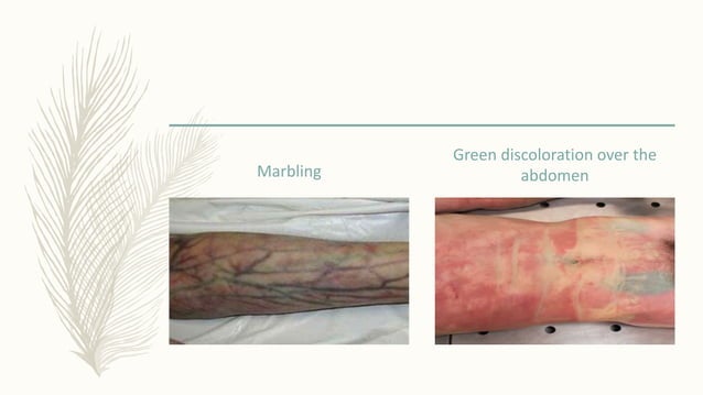 FORENSIC MEDICINE - STAGES OF DEATH | PPTX