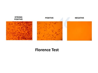 Forensic Medicine - Analysing Seminal Stains.pptx