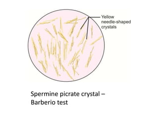 Forensic Medicine - Analysing Seminal Stains.pptx