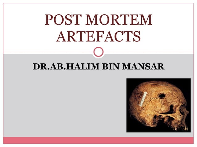 Forensic medicine post mortem artefact | PPT