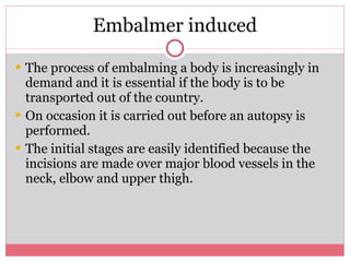 Forensic medicine post mortem artefact | PPT
