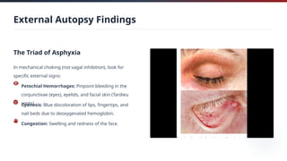 Forensic Medicine - Suffocation & Choking.pptx