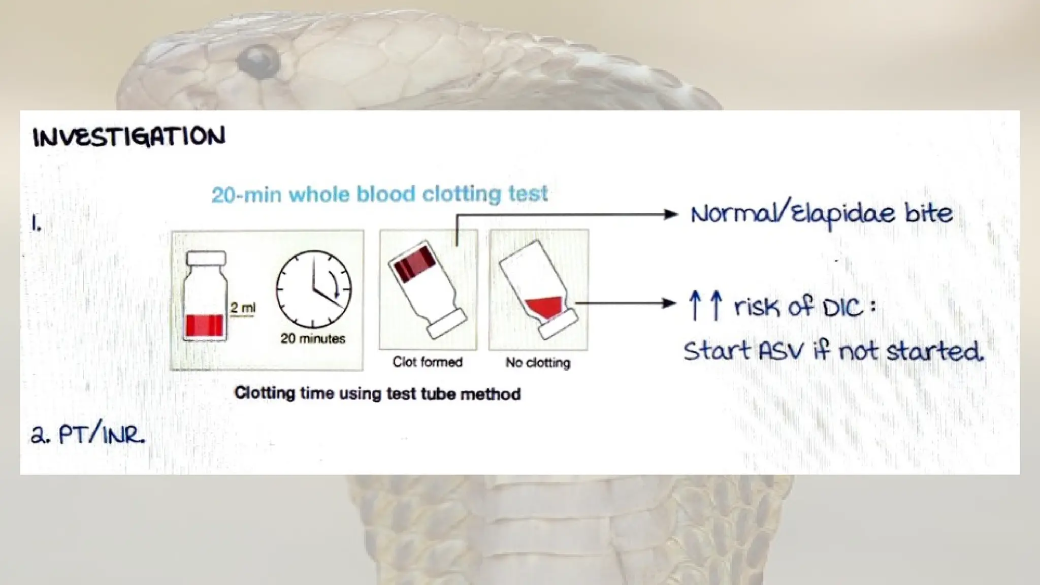 Forensic Medicine Presentation_Snake Bite.pptx_20240807_024821_0000[1].pptx