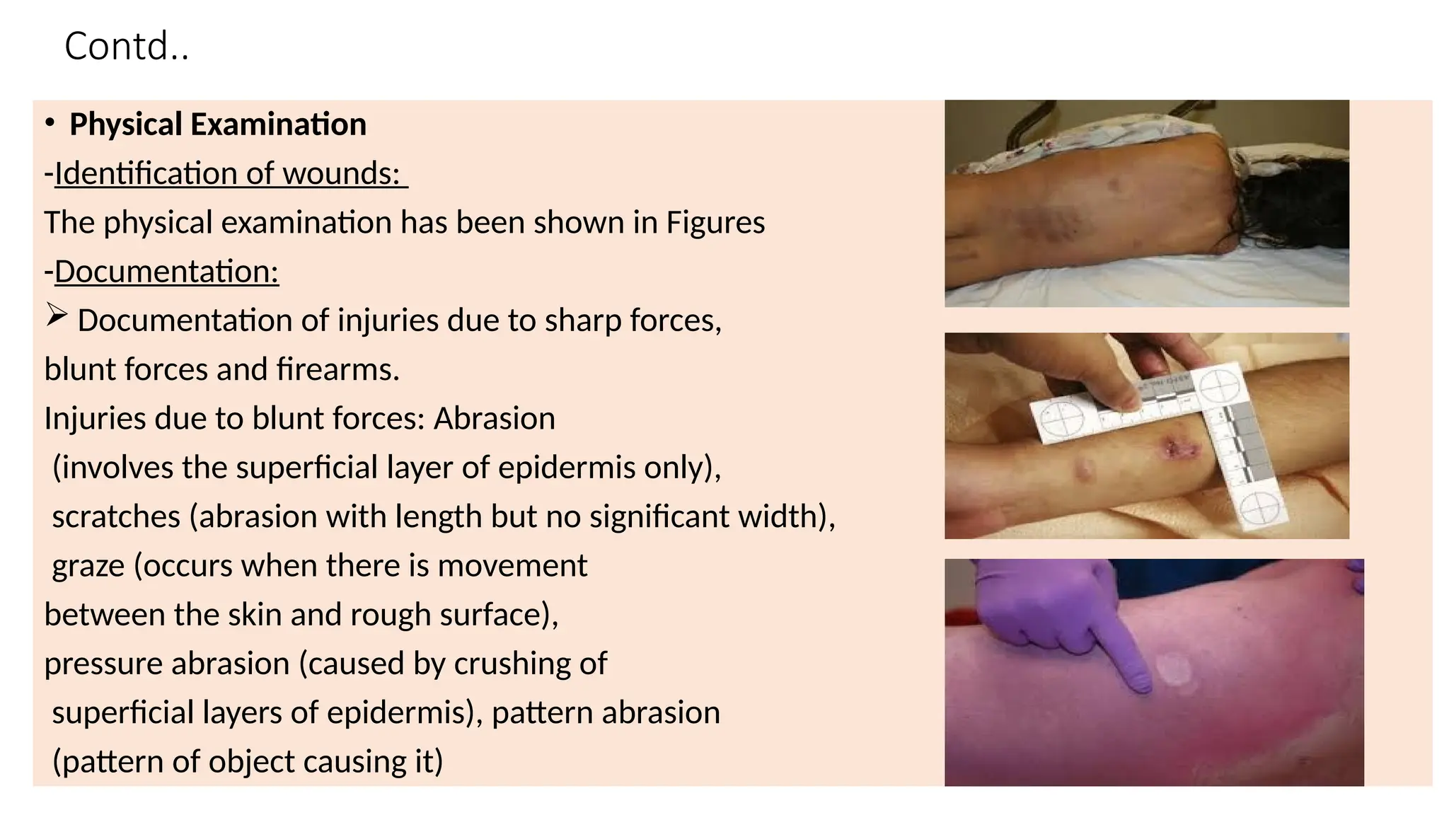 Introduction to Forensic Nursing for 5th semester BSc Nursing | PPTX