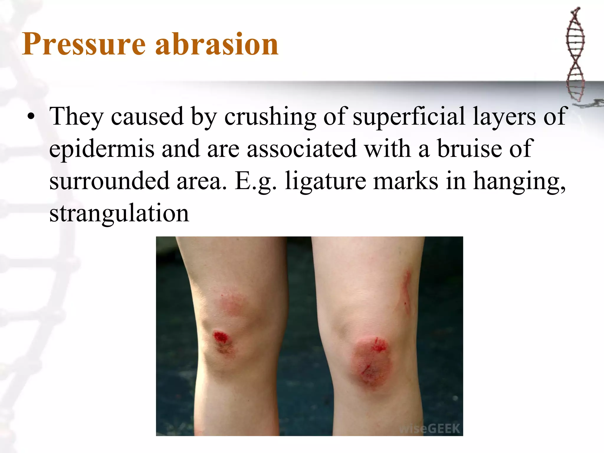 Forensic nursing ppt | PDF