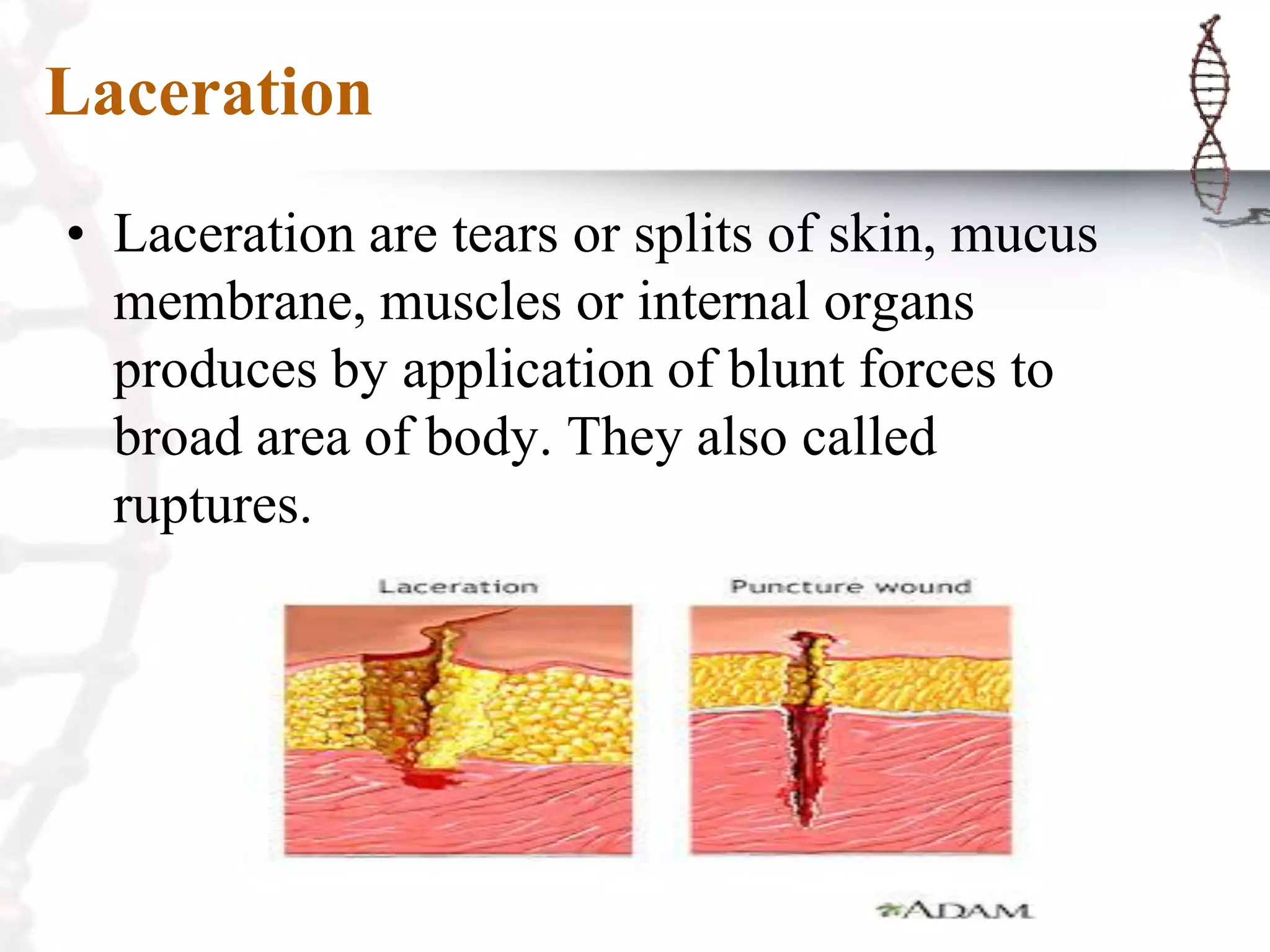 Forensic nursing ppt | PDF