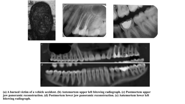 forensic odontogy.pptx