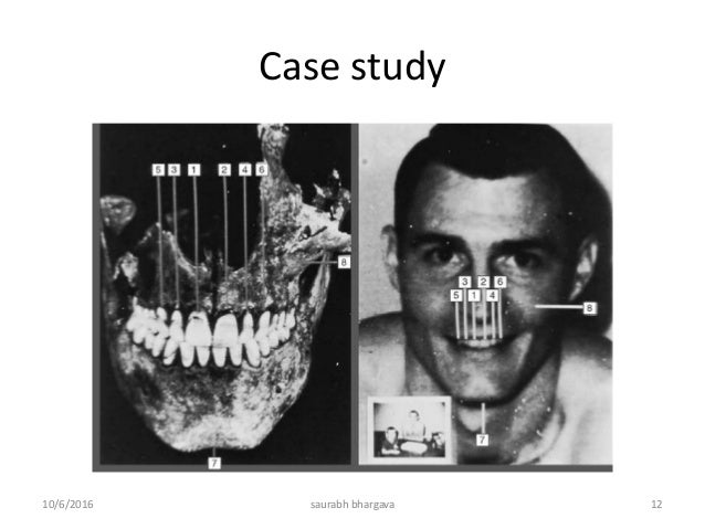 Forensic Odontology