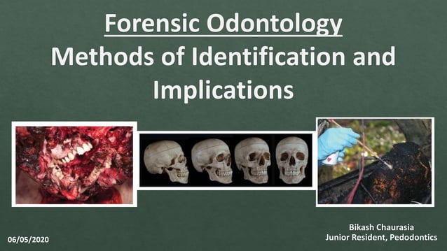 Forensic Odontology | PPT