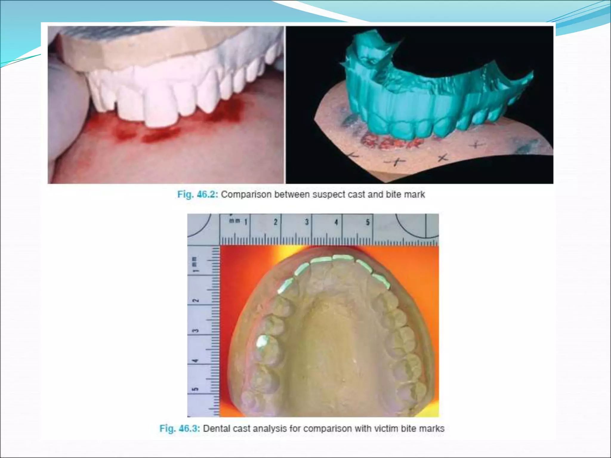 Forensic Odontology.ppt