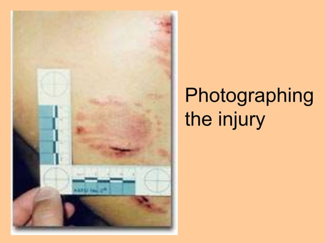 FORENSIC ODONTOLOGY for personal identification | PPT