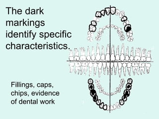 FORENSIC ODONTOLOGY for personal identification | PPT