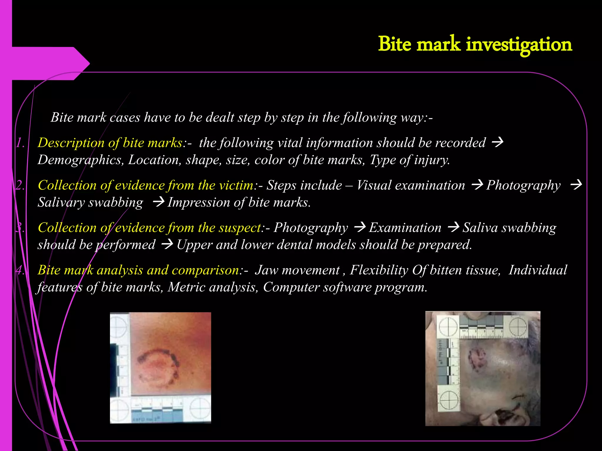 Forensic odontology ppt | PPTX
