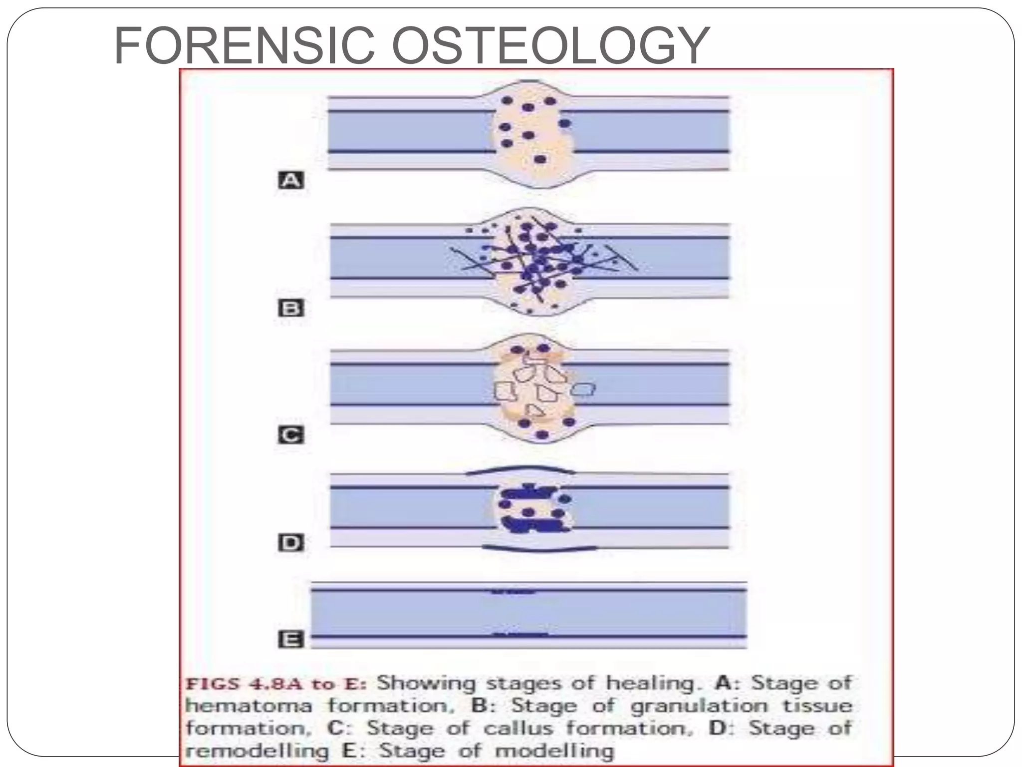 Forensic osteology | PPTX