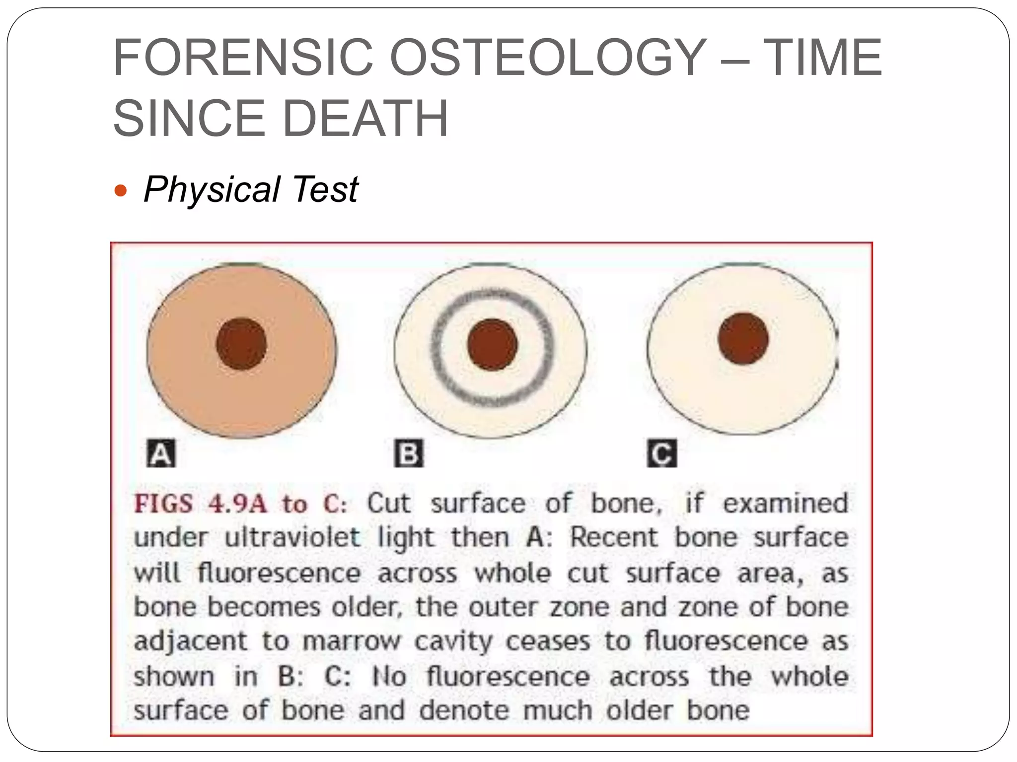 Forensic osteology | PPTX