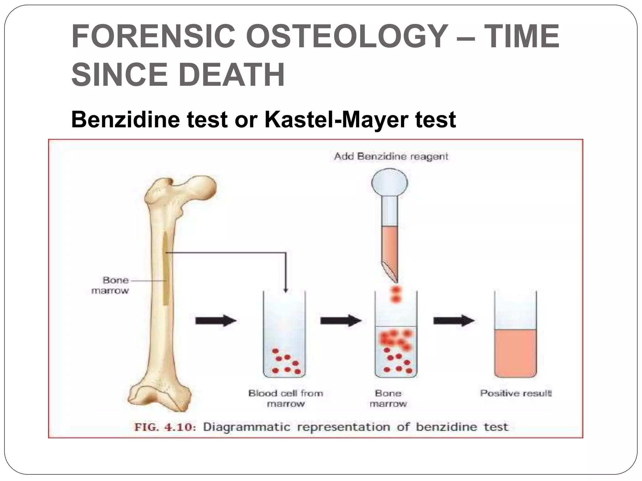 Forensic osteology | PPTX
