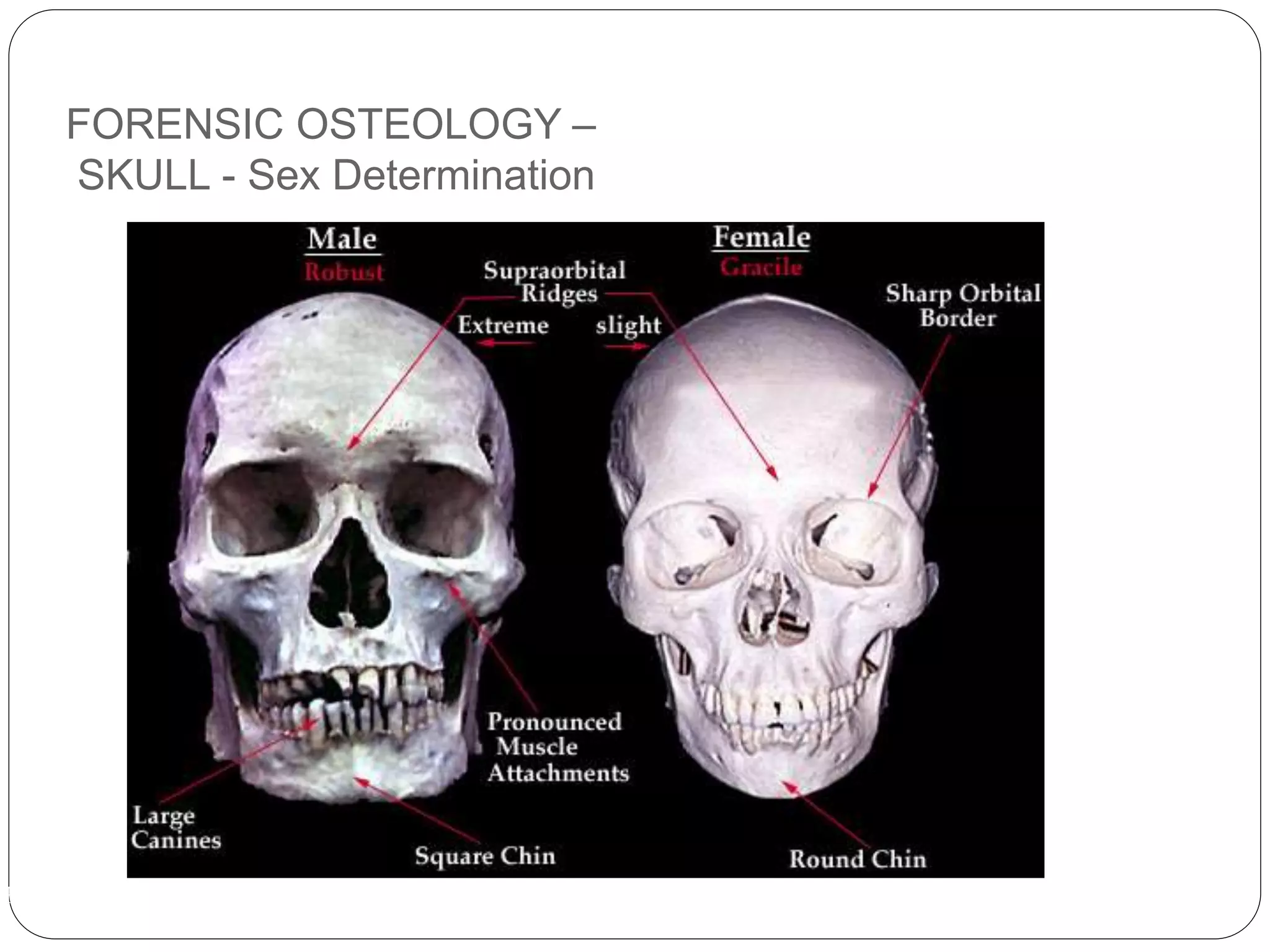 Forensic osteology | PPTX
