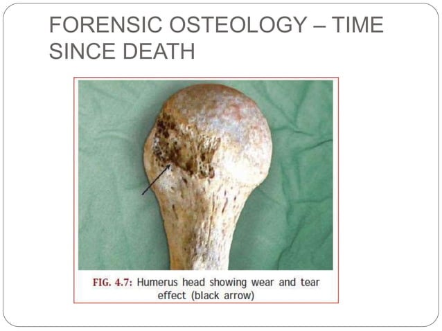 Forensic osteology | PPTX