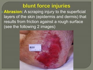 Forensic pathology | PPTX