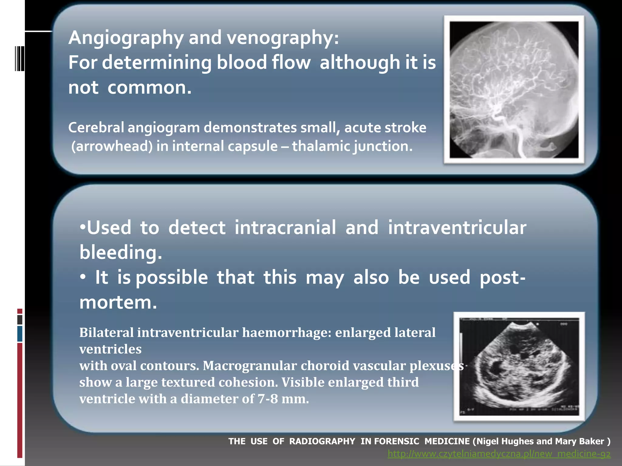 Forensic Radiography | PPTX