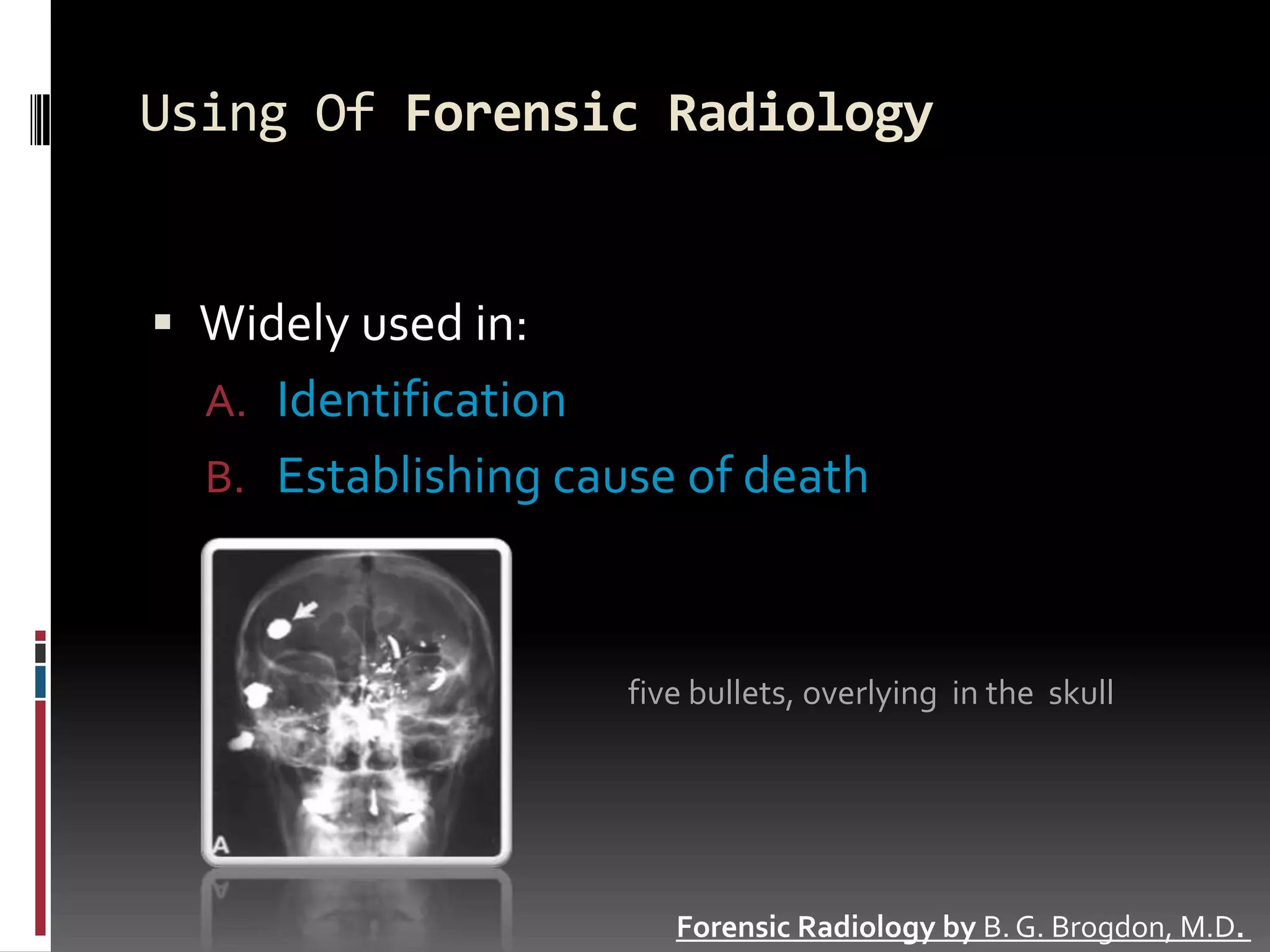 Forensic Radiography | PPTX | Dental Health | Diseases and Conditions