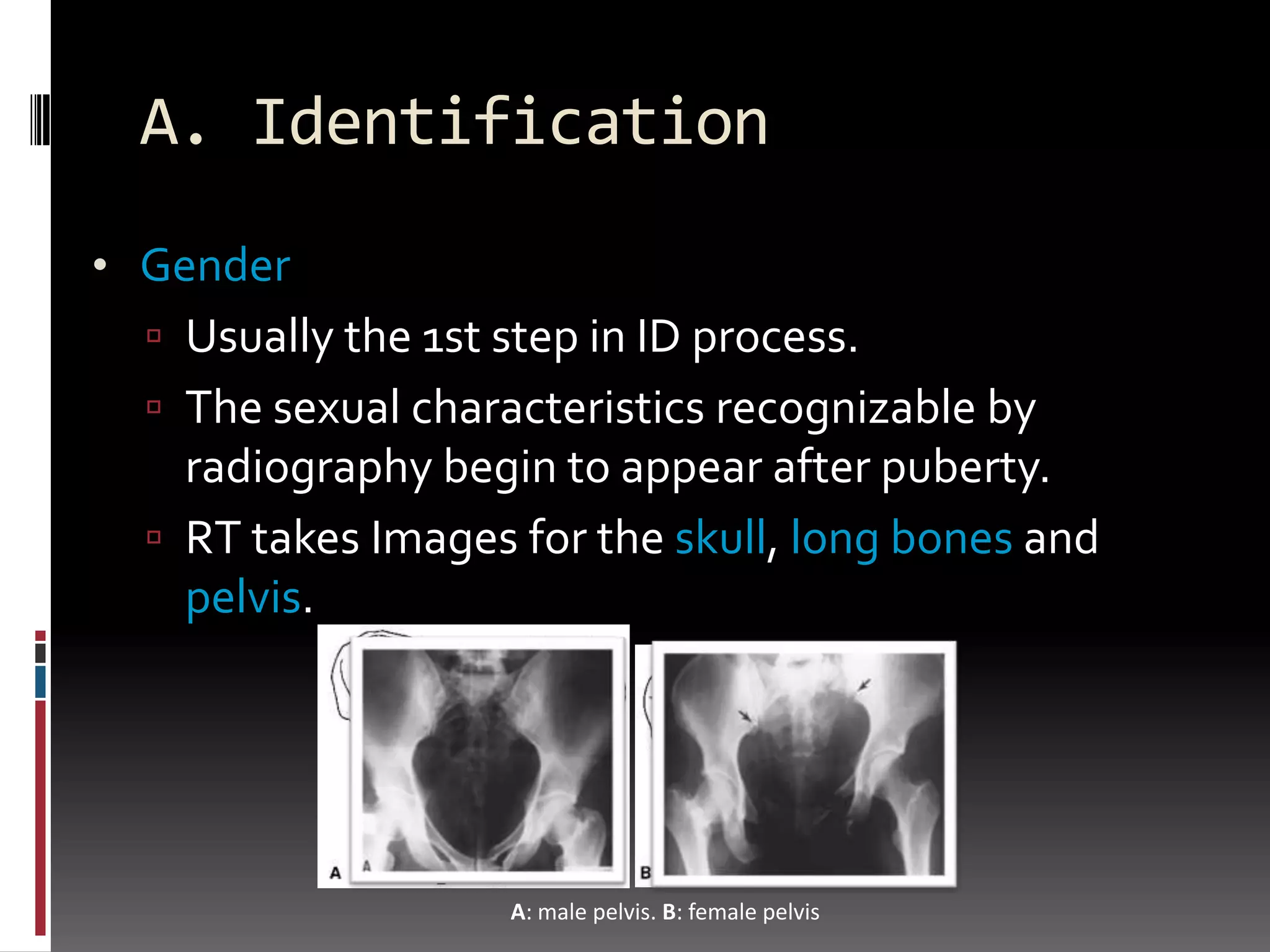 Forensic Radiography | PPTX