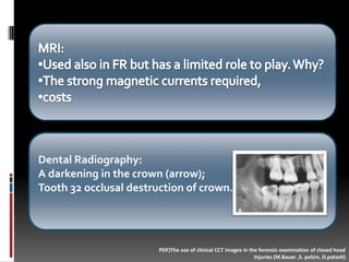 Forensic Radiography | PPTX