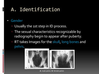 Forensic Radiography | PPTX