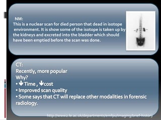 Forensic Radiography | PPTX