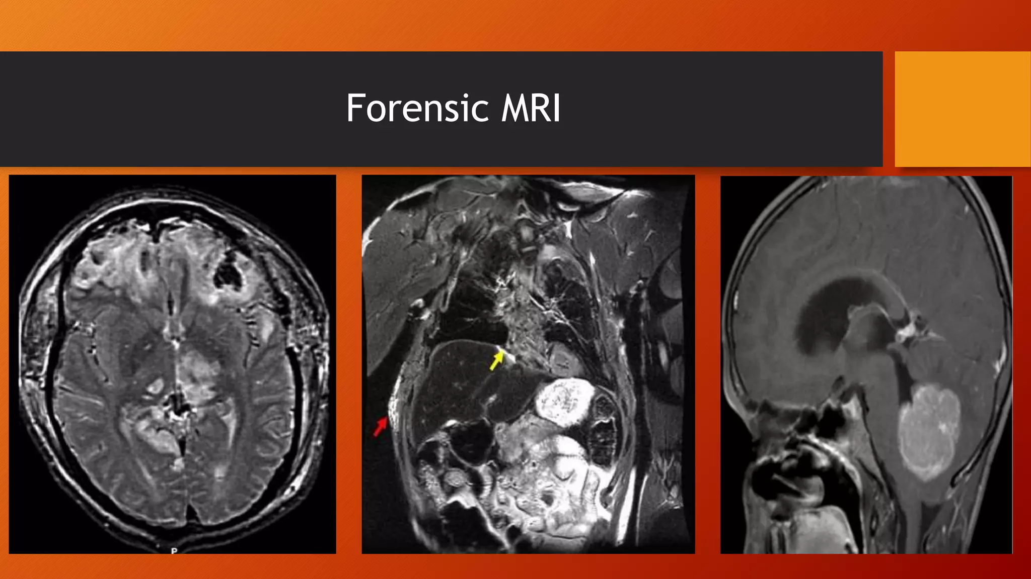 Forensic radiography | PPTX