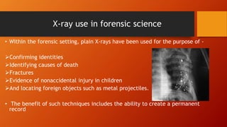 Forensic radiography | PPTX