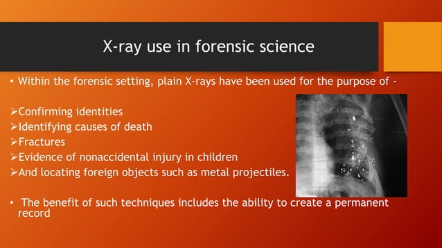 Forensic radiography | PPTX | Dental Health | Diseases and Conditions