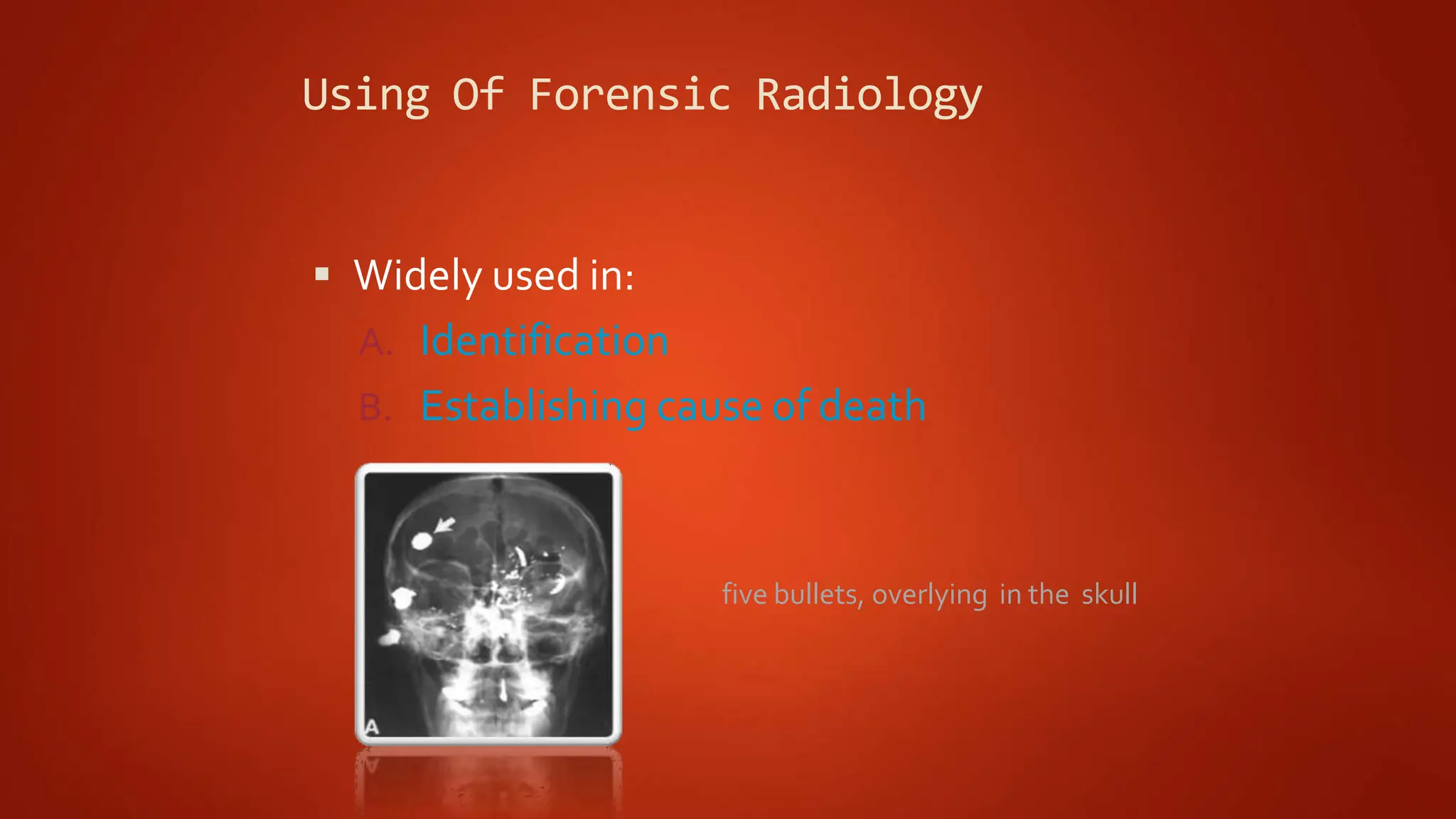 forensicradiography.pptxforensicradiography.pptx