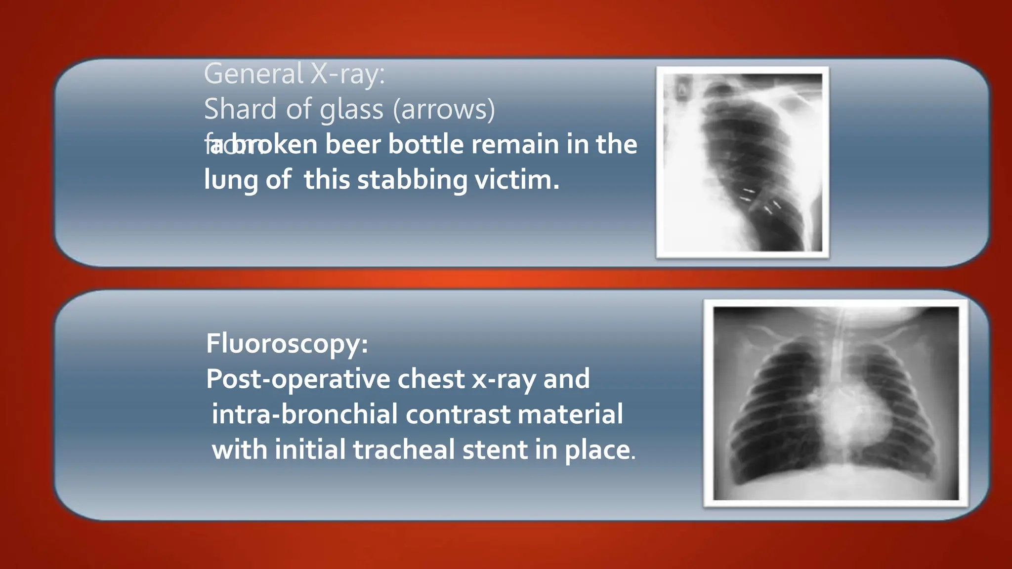 forensicradiography.pptxforensicradiography.pptx