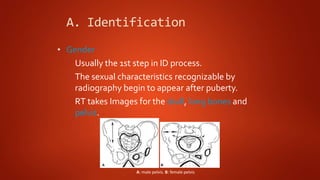 forensicradiography.pptxforensicradiography.pptx