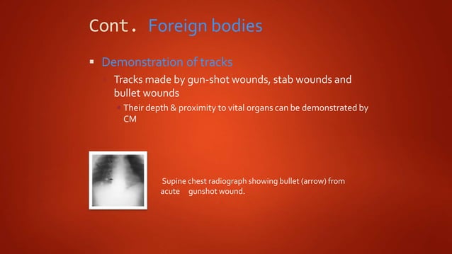 forensicradiography.pptxforensicradiography.pptx