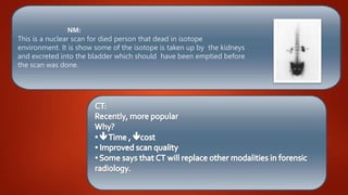 forensicradiography.pptxforensicradiography.pptx