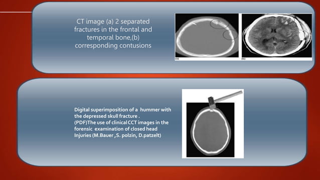 forensicradiography.pptxforensicradiography.pptx
