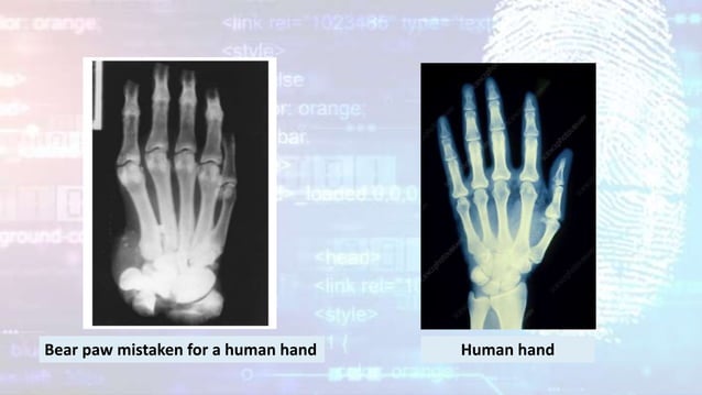 Forensic Radiology | PPTX