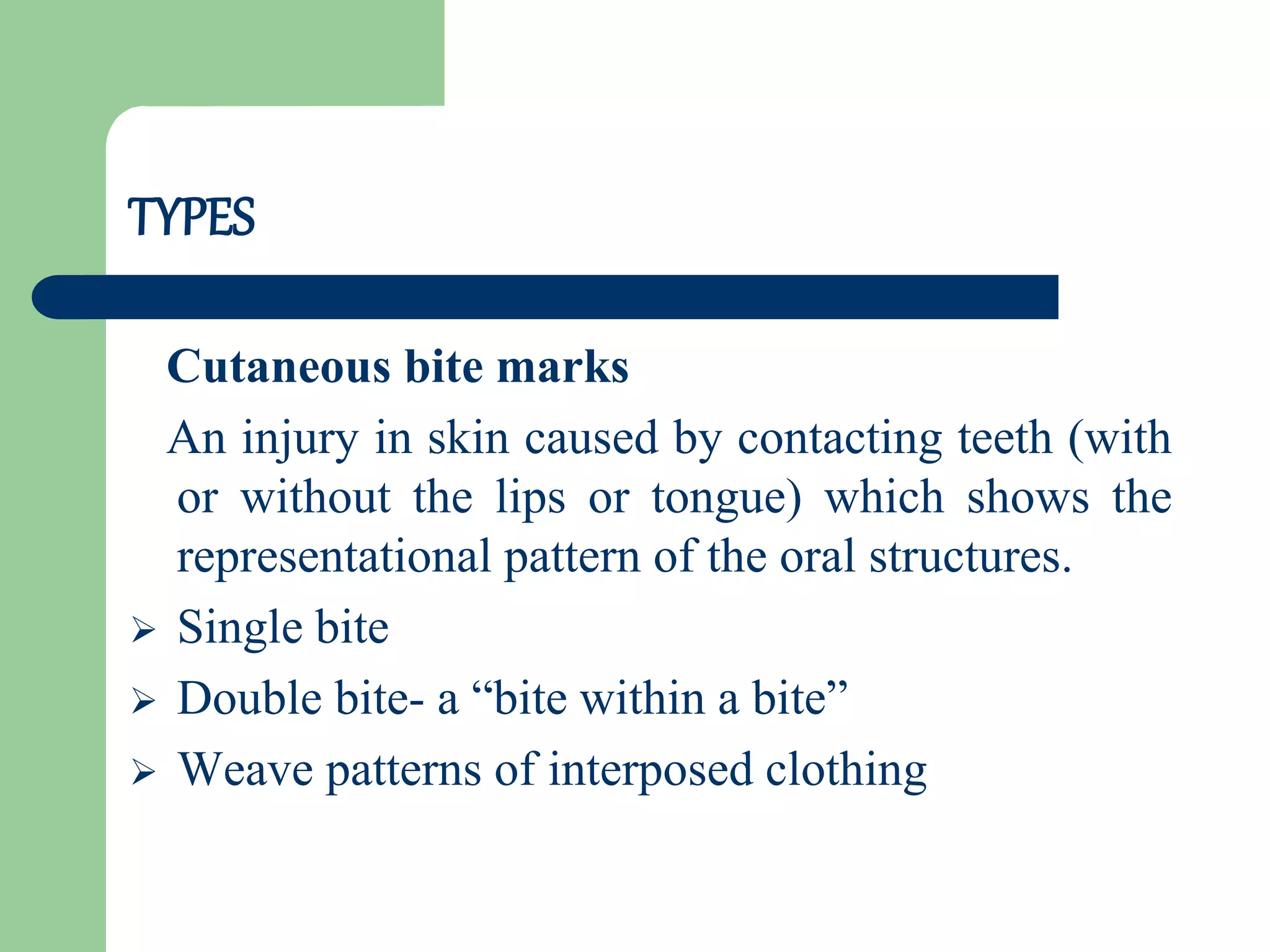 Forensic science bite marks | PPT