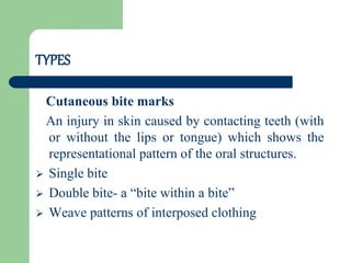 Forensic science bite marks | PPT