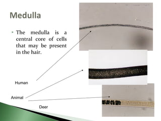 Forensics of hair analysis | PPT