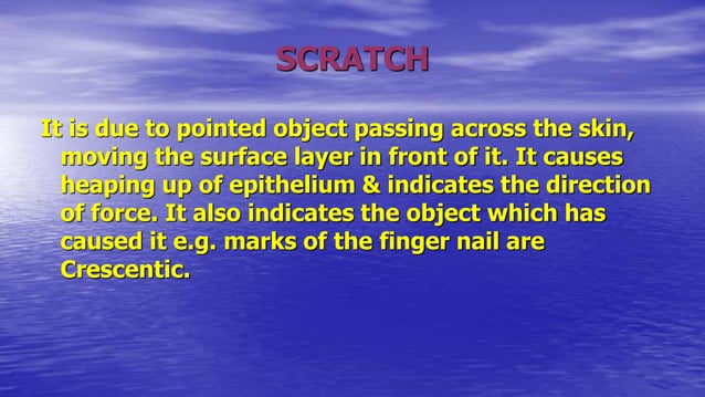 [Forensics] traumatology 2.ppt