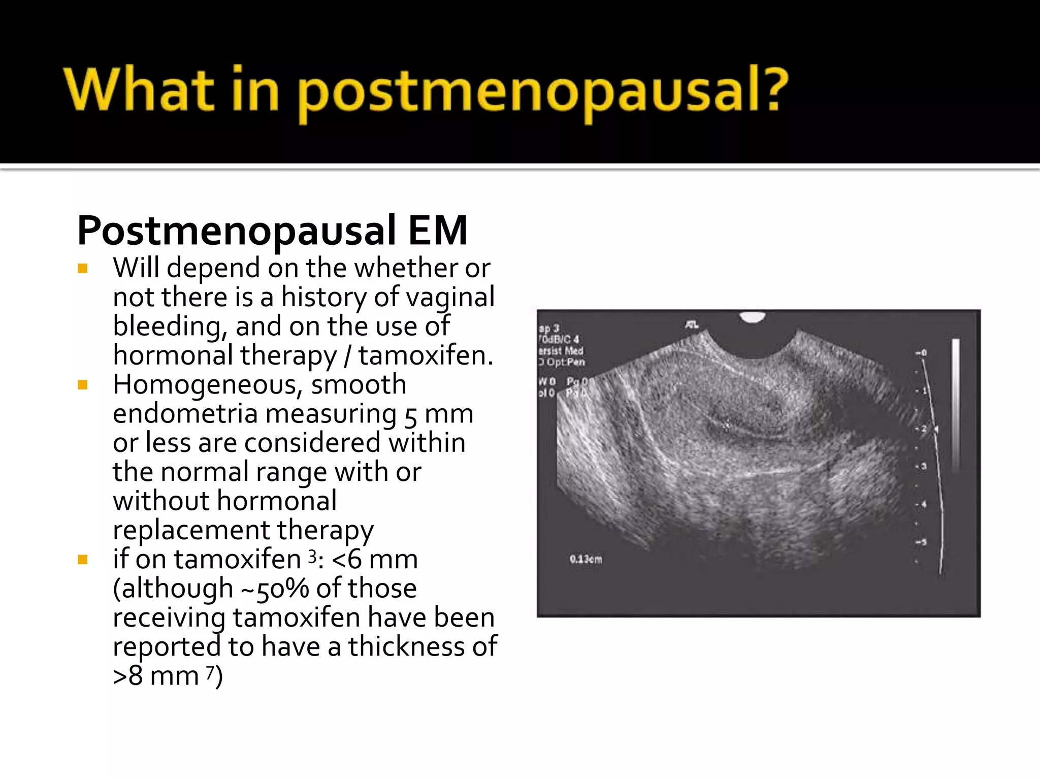 usg in normal menstrual cycle | PPTX