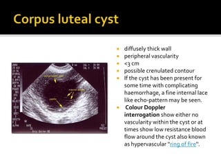 usg in normal menstrual cycle | PPTX